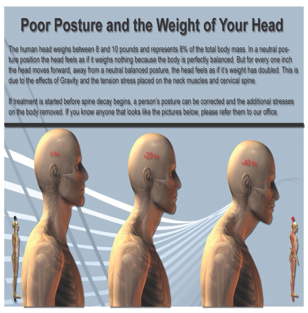 Head Weight and Posture Poster English | VenturaDesigns by Dr. Joe Ventura
